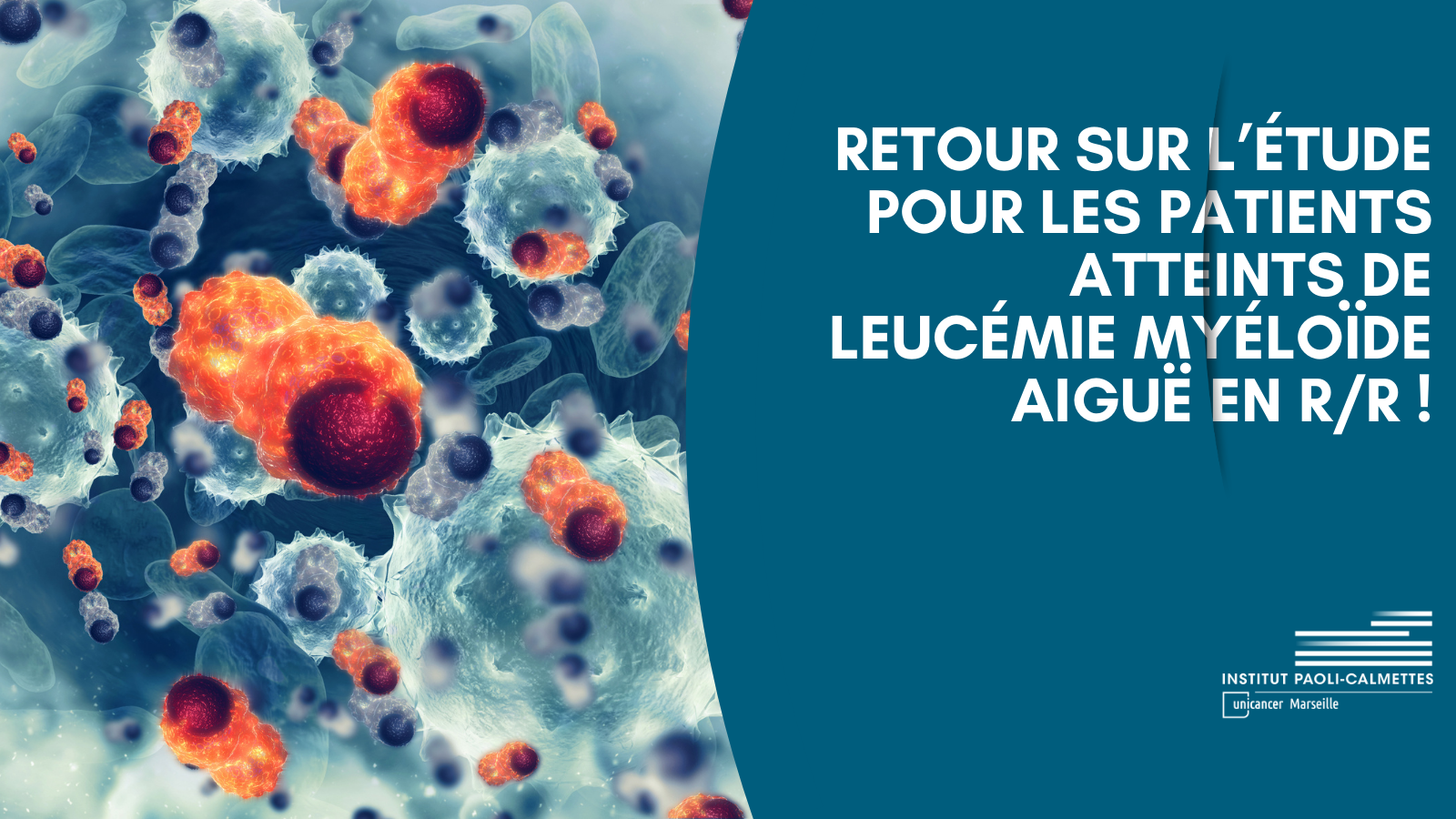 Retour sur l’étude pour les Patients Atteints de Leucémie Myéloïde ...